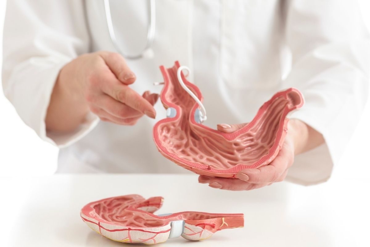 The Ultimate Guide to Gastric Sleeve Surgery | Soraca Med The Ultimate Guide to Gastric Sleeve Surgery | Soraca Med